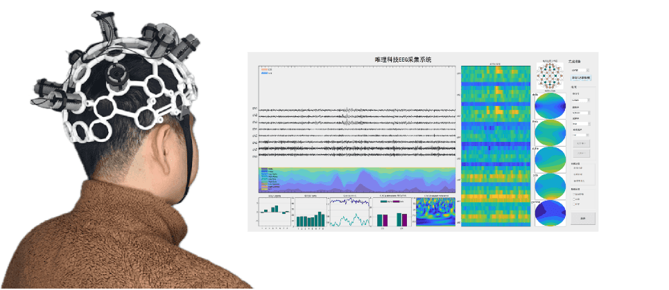 全国产化唯理多通道脑电图EEG采集仪-阿里云开发者社区
